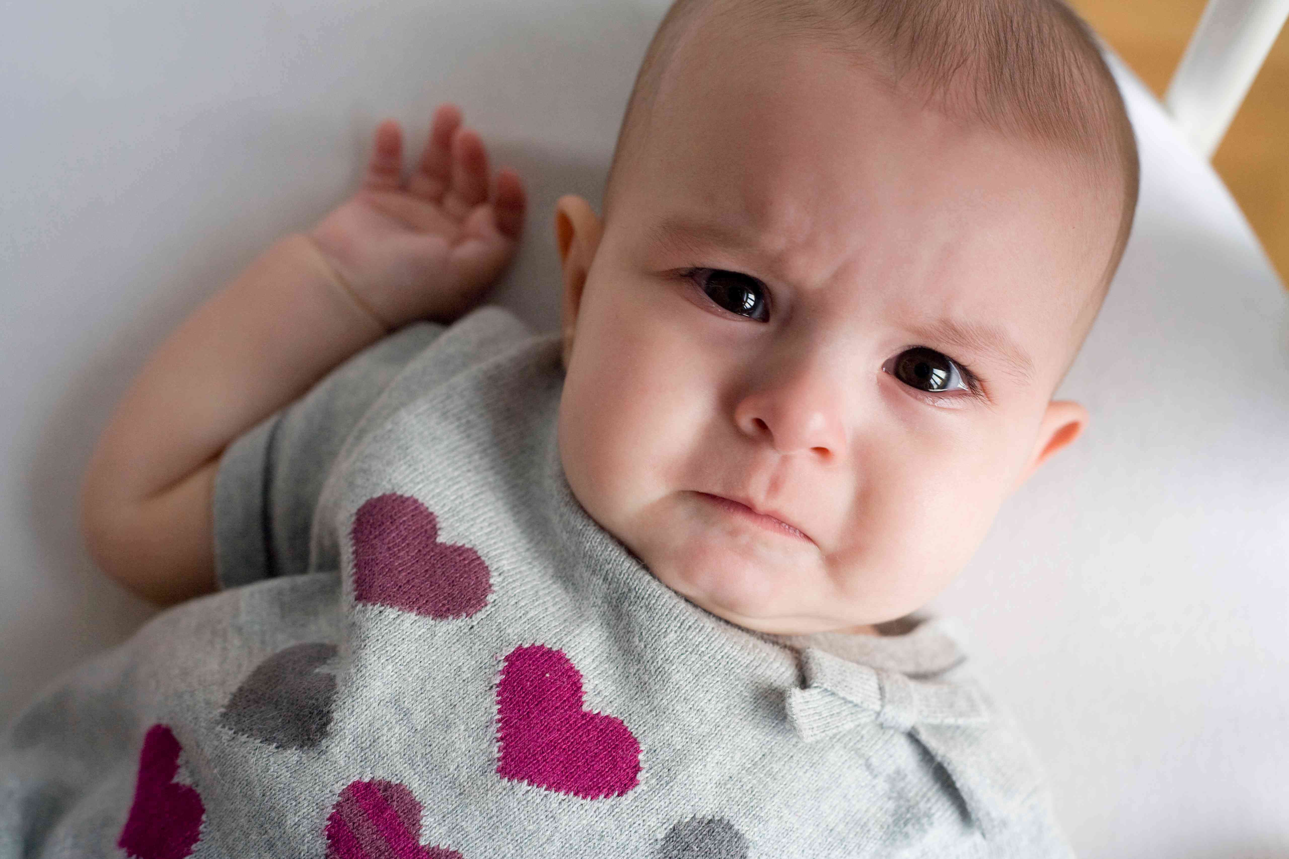 Dermatitis atópica en bebés | Nestlé Bebé